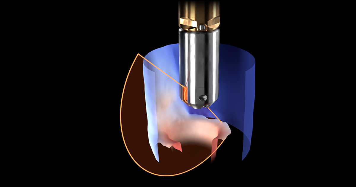 Retrieving A Stuck Valve | Case Study | DarkVision